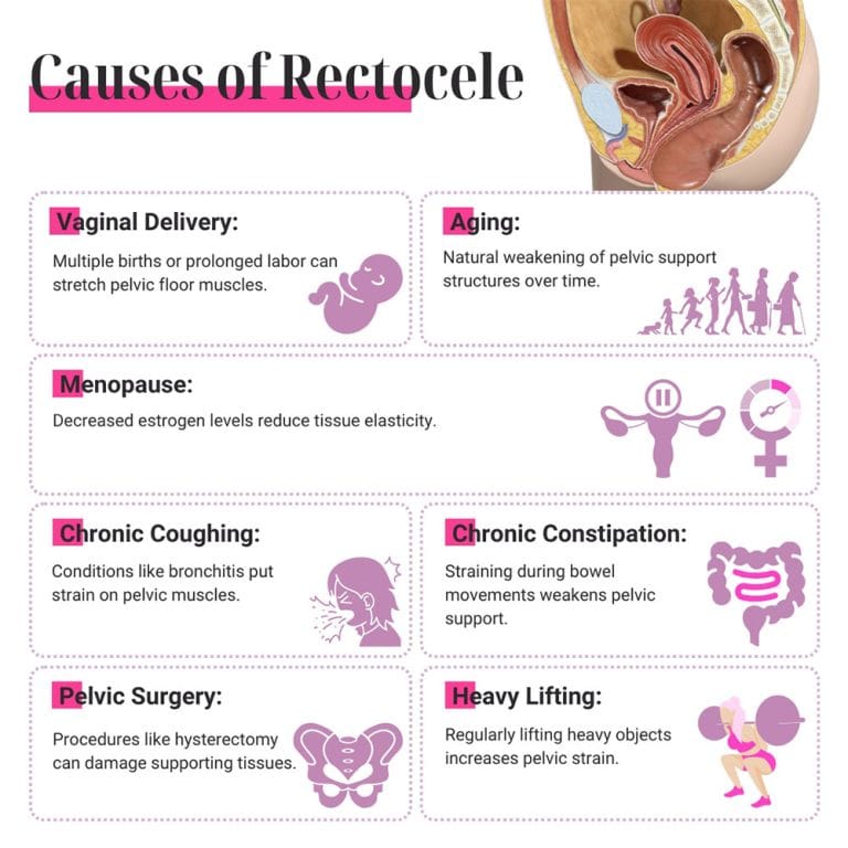 Rectocele Surgery in Midtown, NYC & Rego Park, Queens | Posterior ...