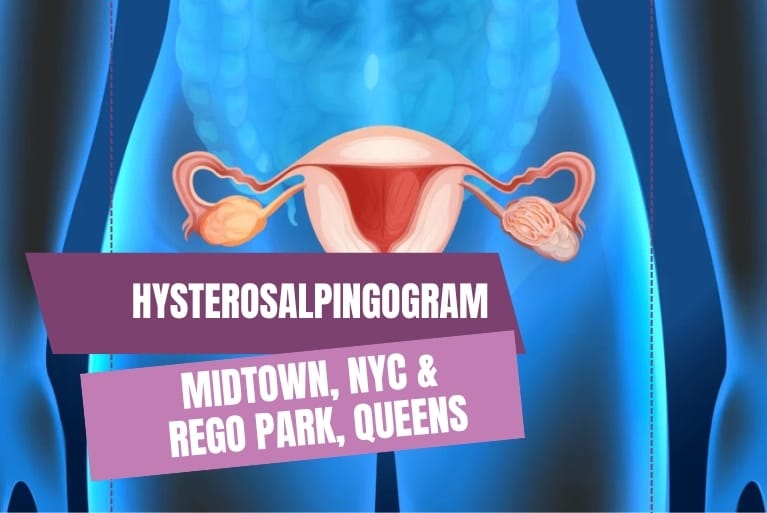 Hysterosalpingogram (HSG) in Midtown, NYC & Rego Park, Queens | Cohen Medical Practice